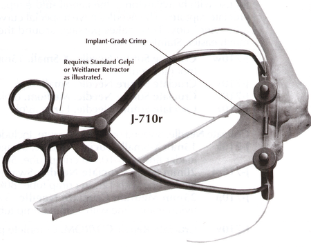 Cruciate Ligament Repair Tension Clamp, Stainless Steel