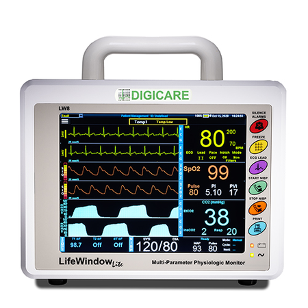LifeWindow 8V LITE Monitor: NIBP/ SpO2/ 3-Lead ECG/ Temp (Optional ...