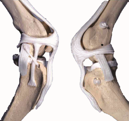 LigaFiba Lateral Suture with Needles, 250#