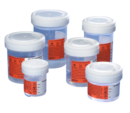 Specimen Jar, Polystyrene, with 10% Phosphate Buffered Formalin, 120mL